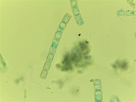 Microscopic View Of The Filamentous Diatom Melosira Showing Auxospore