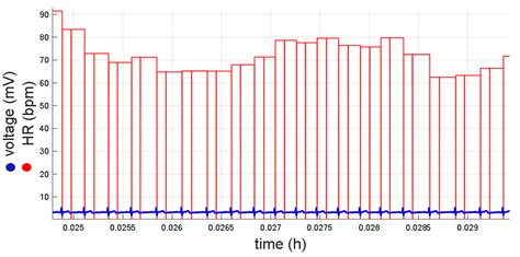 Implementation Of Wavelet Transform Based Algorithms In An Fpga For