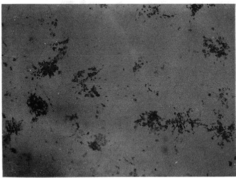 Flat Mounts Of Diseased Cells In Punctate Lesions After Dissolving