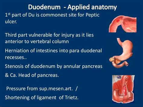 Anatomy Of Duodenum Duodenum Structure Ppt Of Duodenum Power Point…