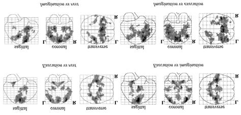 Statistical Parametric Maps Spms Of The Group Analysis Random Download Scientific Diagram