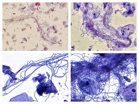 Leptothrix Pap Smear Leptothix Are Gram Positive Bacteri… Flickr