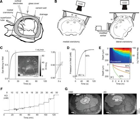 Susceptibility Of Primary Sensory Cortex To Spreading Depolarizations Pmc