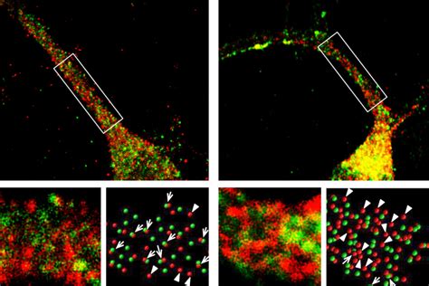 Mutations In The Foxp2 Gene Have Been Linked To Apraxia And Disrupt The