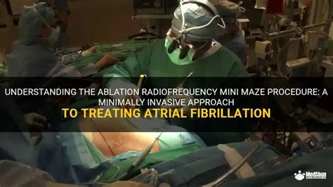 Understanding The Ablation Radiofrequency Mini Maze Procedure A Minimally Invasive Approach To