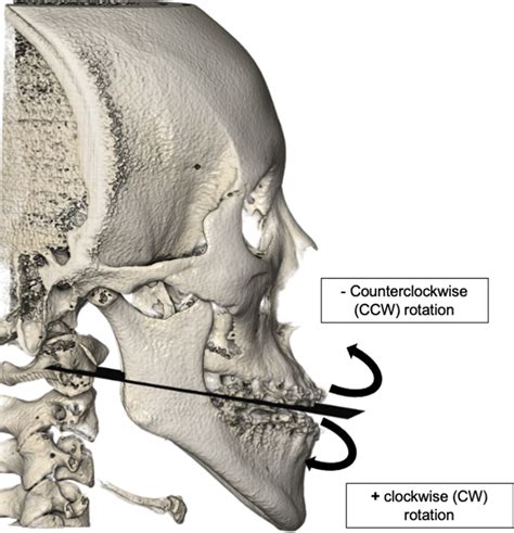 Visual Representation Of The Direction Of Clockwise And Download Scientific Diagram