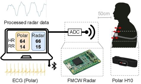 Poster Abstract Contactless Vital Sign Monitoring Using Low Power Fmcw Radar