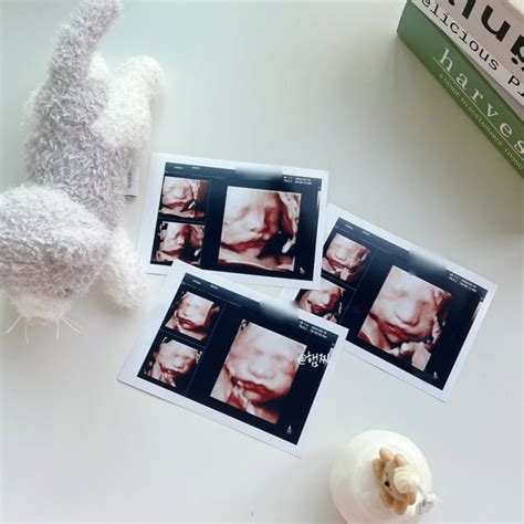 임신 중기 20주 ~25주 일상 임당검사 입체초음파 성공 임당재검 네이버 블로그