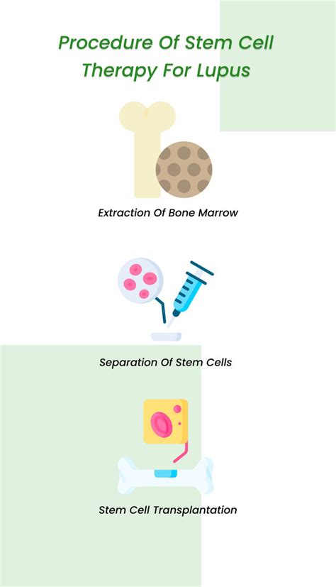 Stem Cell Therapy For Lupus 2023 All You Need To Know Clinicspots