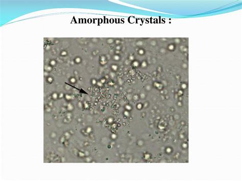 Ppt Urine And Stool Examination Powerpoint Presentation Free