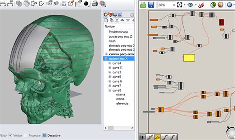 Cranial Implant Implants Design Industrial Design