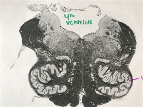 Medulla Open Level Of Cranial Nuclei X And XII Diagram Quizlet