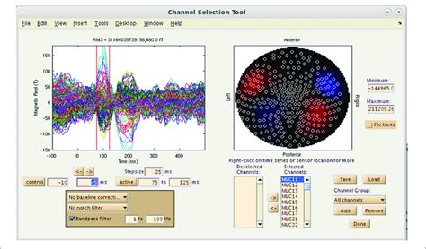 sensor preprocessing gui on the left sensor overlay of the averaged