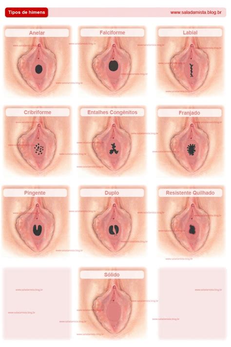Buna TPU Am O Prietena Tare Speriata Si Vreau Sa O Sfatuiesc Din Cate Am Inteles Ea Are