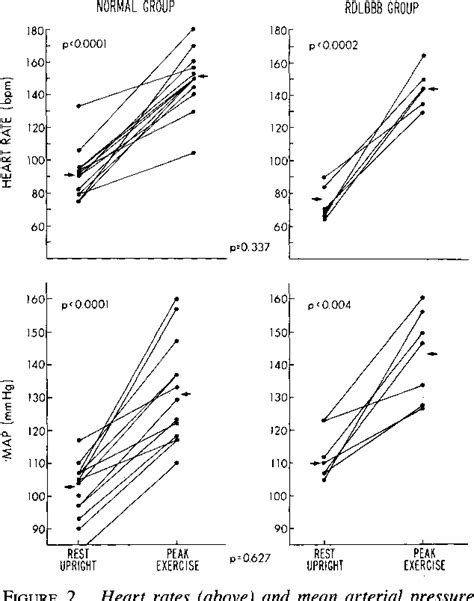 Figure 1 From Effects Of Rate‐dependent Left Bundle Branch Block On Global And Regional Left