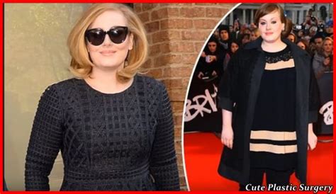 Adele Plastic Surgery Evolution Rhinoplasty Liposuction Celebrities Plastic Surgery