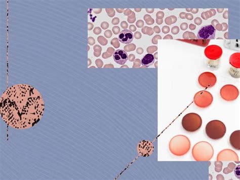 steven berkey cpc cpb cpco cosc canpc cpcd cfpc crhc on linkedin all about the different types