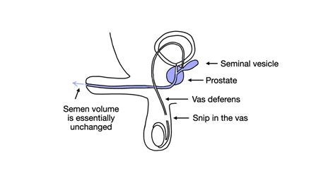 Anatomy For Vasectomy Vasectomy Resources