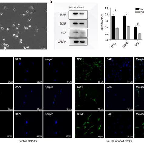 Dental Pulp Stem Cells Can Differentiate Into Neural Like Cells And