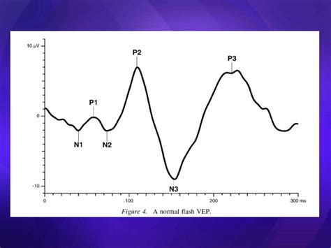 Visual Evoked Potential