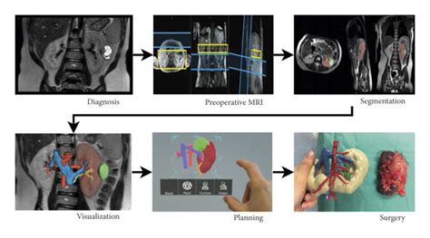 Schematic Overview Of The Proposed Preoperative 3d Visualization