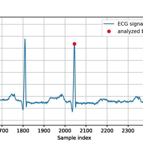 Illustrative Ecg Signal Except Of A Premature Atrial Contraction Pac Download Scientific