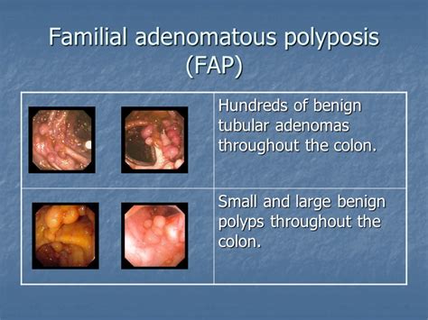 Colonic Polyps Made By Islamova Sh Group