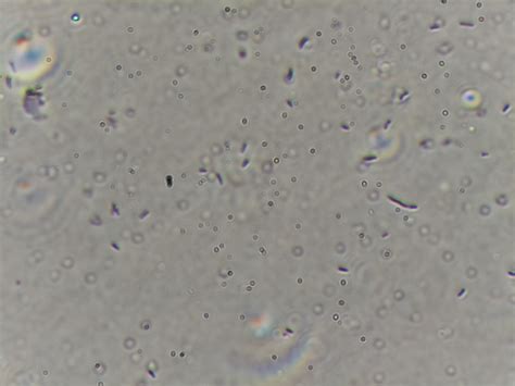 Ecoli Object Detection Computer Vision Dataset By Ens Parissaclay