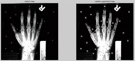 Matlab实现：图像边缘提取matlab边缘提取 Csdn博客