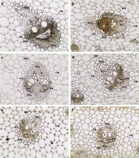 Light Microscope Transverse Section Of Vascular Bundle In The Midrib