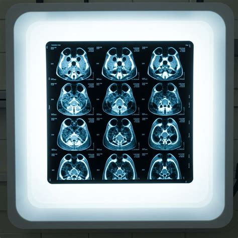 How Mit Researchers Made Ai Models More Trustworthy For High Stakes