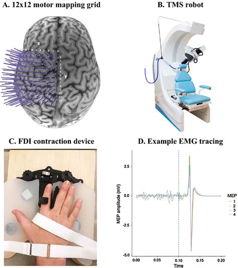 Neuro Navigated Robotic Tms Motor Mapping During Isolated Fdi