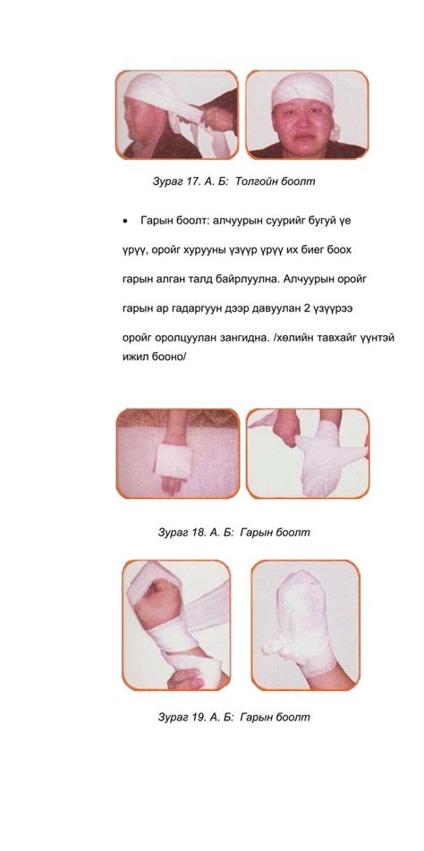 Осол гэмтлийн үед үзүүлэх анхны тусламж Pdf