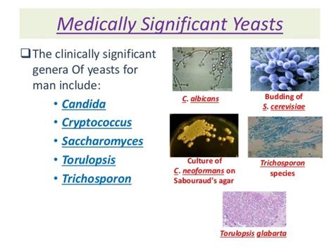 Medically Significant Yeasts