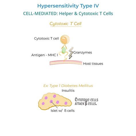 Clinical Pathology Glossary Hypersensitivity Type Iv Ditki Medical And Biological Sciences