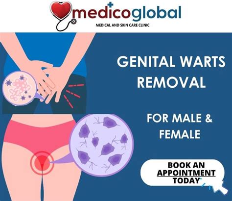Male Genital Warts Treatment