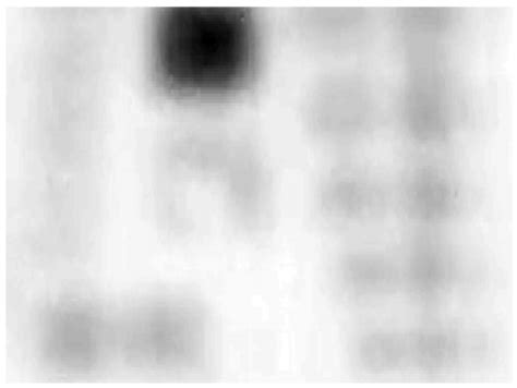 Imaging Through Underwater Turbulence In Natural Environment