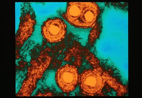 Así Se Ven El Virus Nipah El Vih Y Otros Bajo El Microscopio