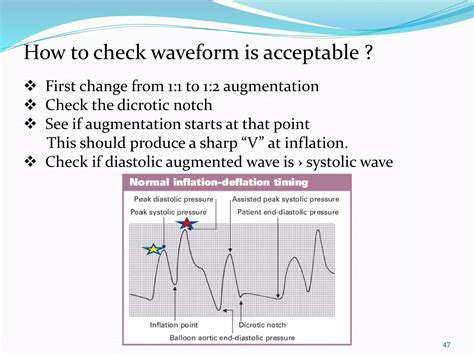 Iabp Instrumentation Indications And Complications Ppt
