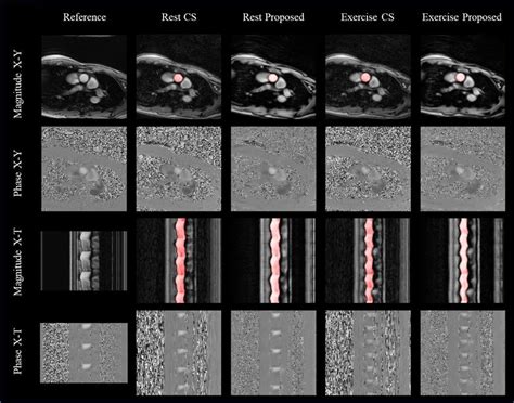 Reference Repeated For Three Cycles Compressed Sensing Cs And Download Scientific Diagram
