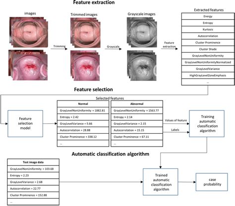 Ml Model Training Process For Cervical Cancer Classification The Download Scientific Diagram