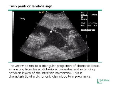 Twins Clinical Management 2012