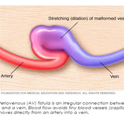 He5 Bleeding Disorders Vascular Abnormalities Flashcards Quizlet