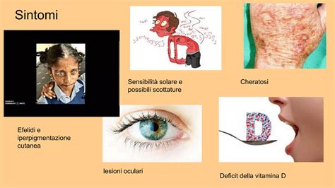 Lucesoli Amicucci Xero 4 B Ppt