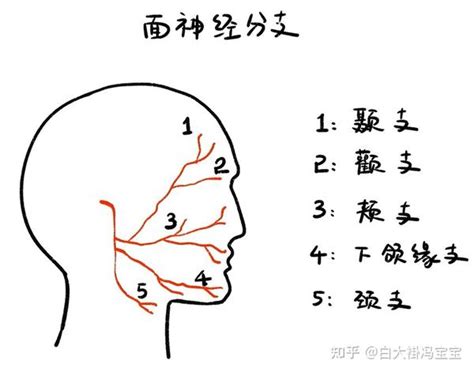 周围性面瘫 知乎