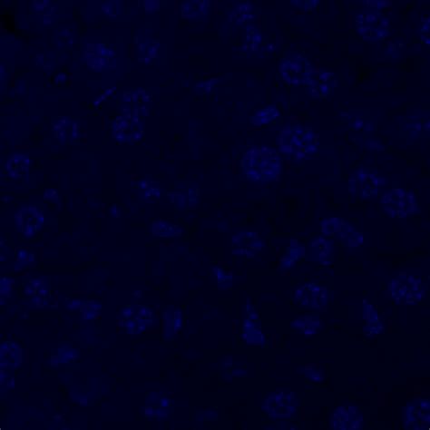 3D Image Preprocessing And Nuclear Segmentation Image Analysis