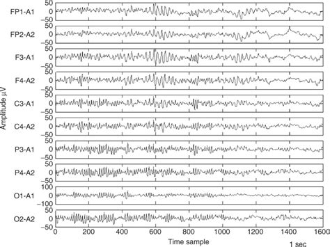 Sleep Eeg Thoracic Key