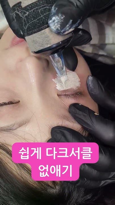 다크서클 쉽게 지우자 다크서클 다크서클제거 다크서클커버 다크서클타투 기미 기미제거 기미타투 두피 두피관리 흉터커버헤어라인헤어라인정리헤어라인타투대구