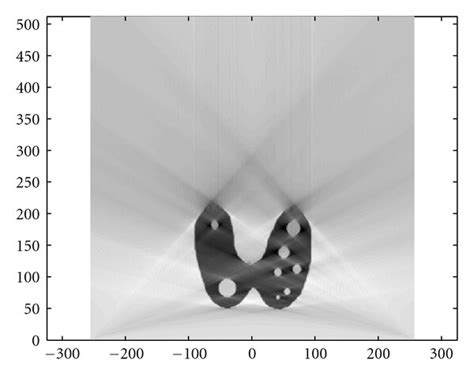 Fbp Im Reconstruction Of The Thyroid Phantom With Dω 0 0025 Rad Download Scientific Diagram