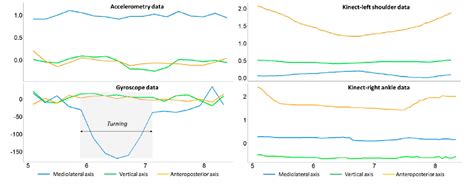 Figure 1 From Design Of A Sensor Technology Augmented Gait And Balance Monitoring System For